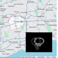 Deer Park Man Who Worked At Dix Hills Facility Accused Of Having Sex ...