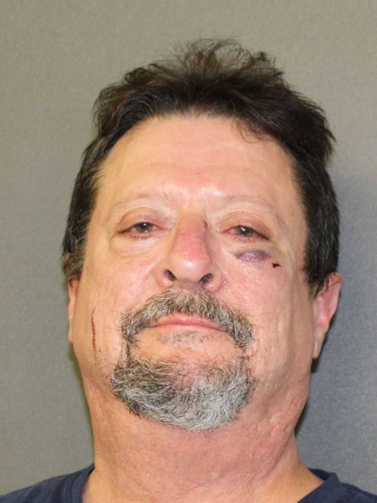 Suspect Apprehended After Assault With Baseball Bat In Maryland ... Suspect Apprehended After Assault With Baseball Bat In Maryland ...