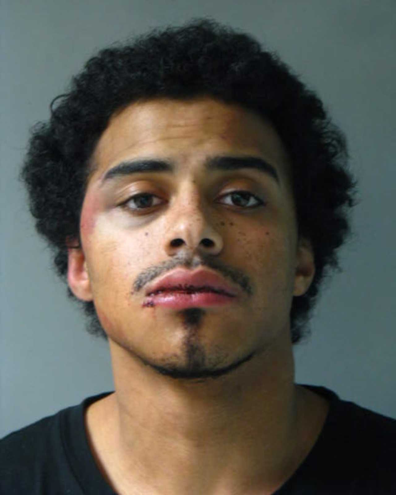 Northern Westchester Man Accused Of Stabbing, Choking Victim During ...