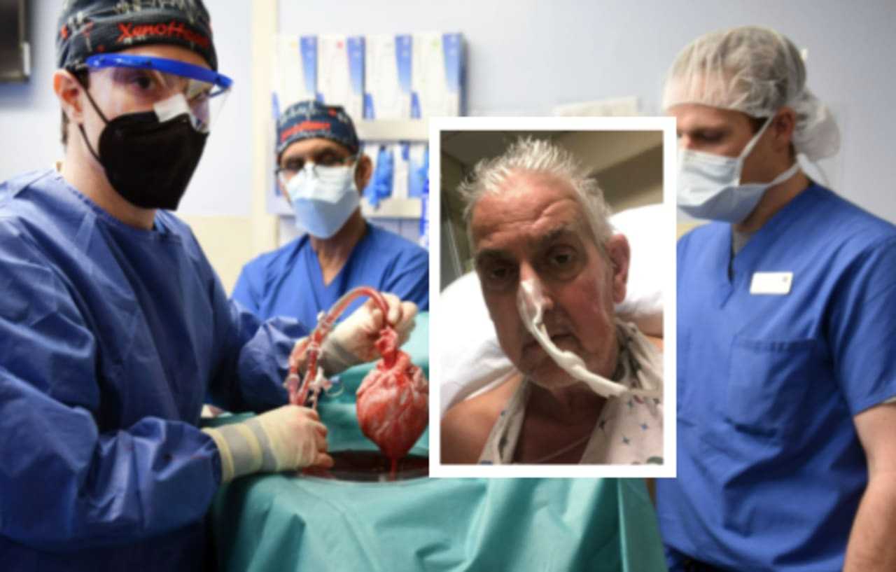 Faced With Death, Man Becomes First Human To Get Heart Transplant From ...